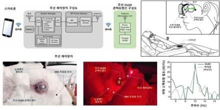 스마트 콘택트렌즈로 망막 진단 시대 연다…국내 연구진 세계 첫 개발